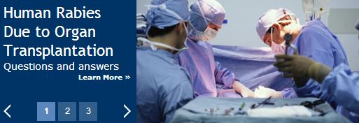 Georgia Transplant Patient Getting Rabies Treatment – WABE