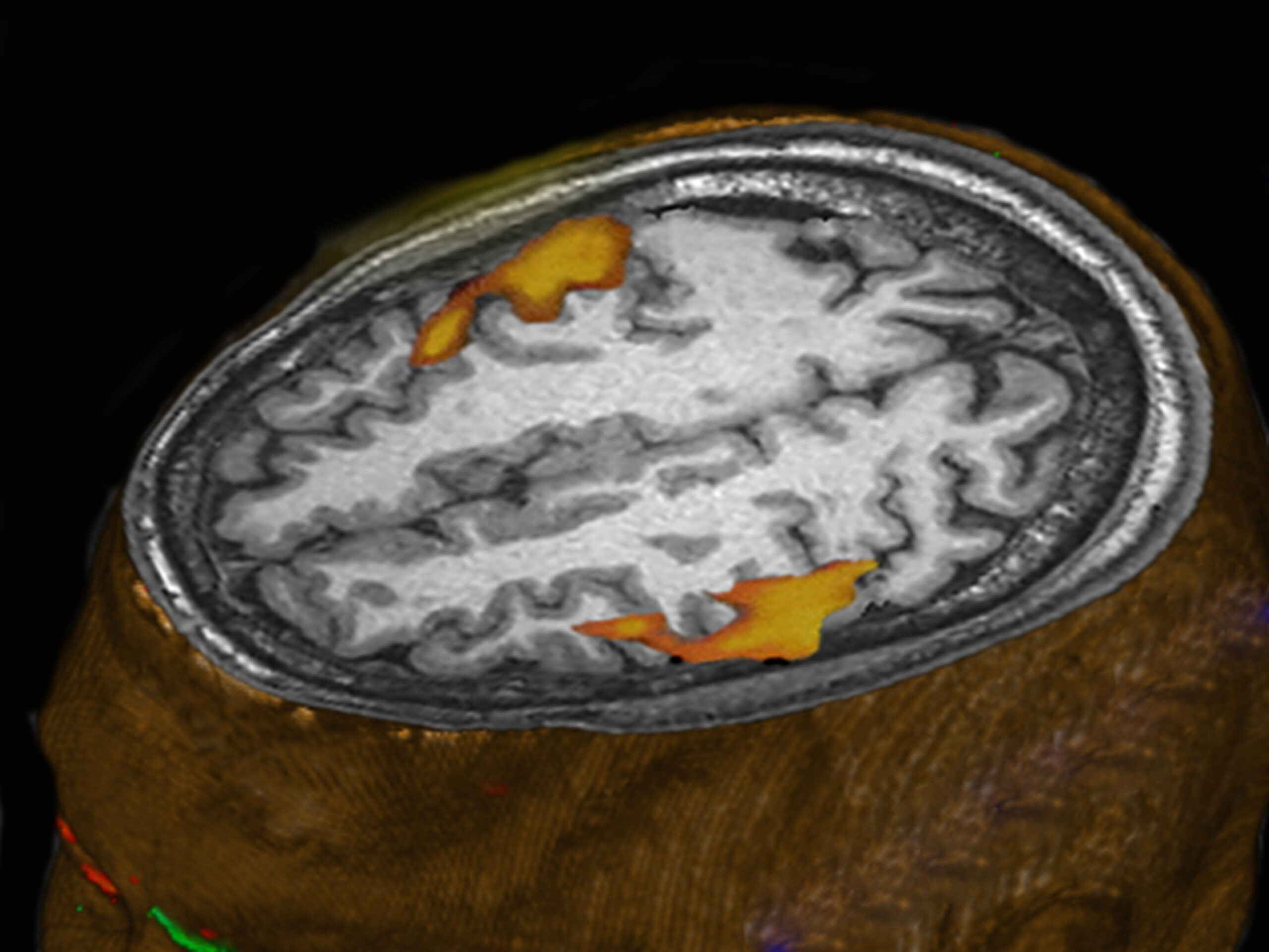 A Musical Brain May Help Us Understand Language And Appreciate ...