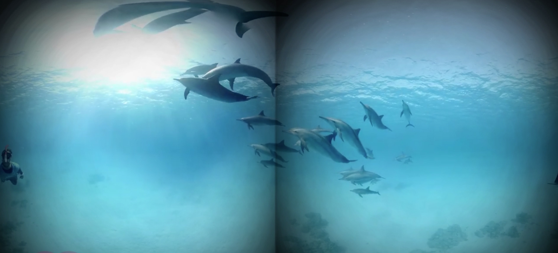 Got Pain? A Virtual Swim With Dolphins May Help Melt It Away – WABE